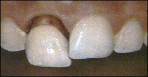 Community Dental Services | Southern Health & Social Care Trust