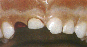 Community Dental Services | Southern Health & Social Care Trust