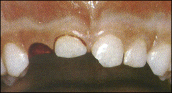 Community Dental Services | Southern Health & Social Care Trust